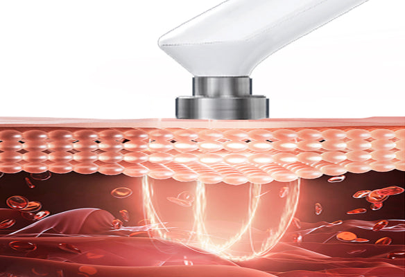 Professional IPL Hair Removal and RF Instrument Manufacturer – MLAY